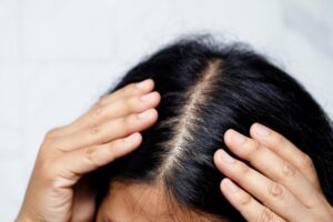Sensitive Scalp Solutions: Causes, Treatments & Tips