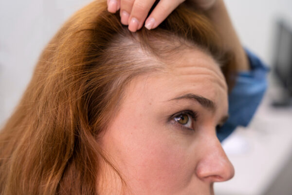 Hair Breakage: Causes, Treatments & How to Stop It for Good