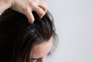13 Common Scalp Conditions: Causes, Symptoms & Treatments